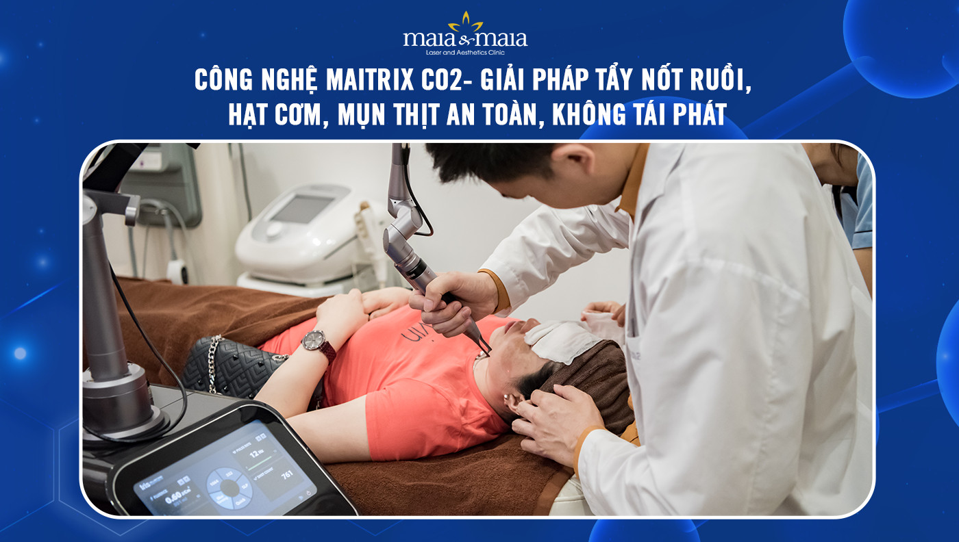 Công nghệ Maitrix CO2 giải pháp tẩy nốt ruồi, hạt cơm, mụn thịt an toàn ...
