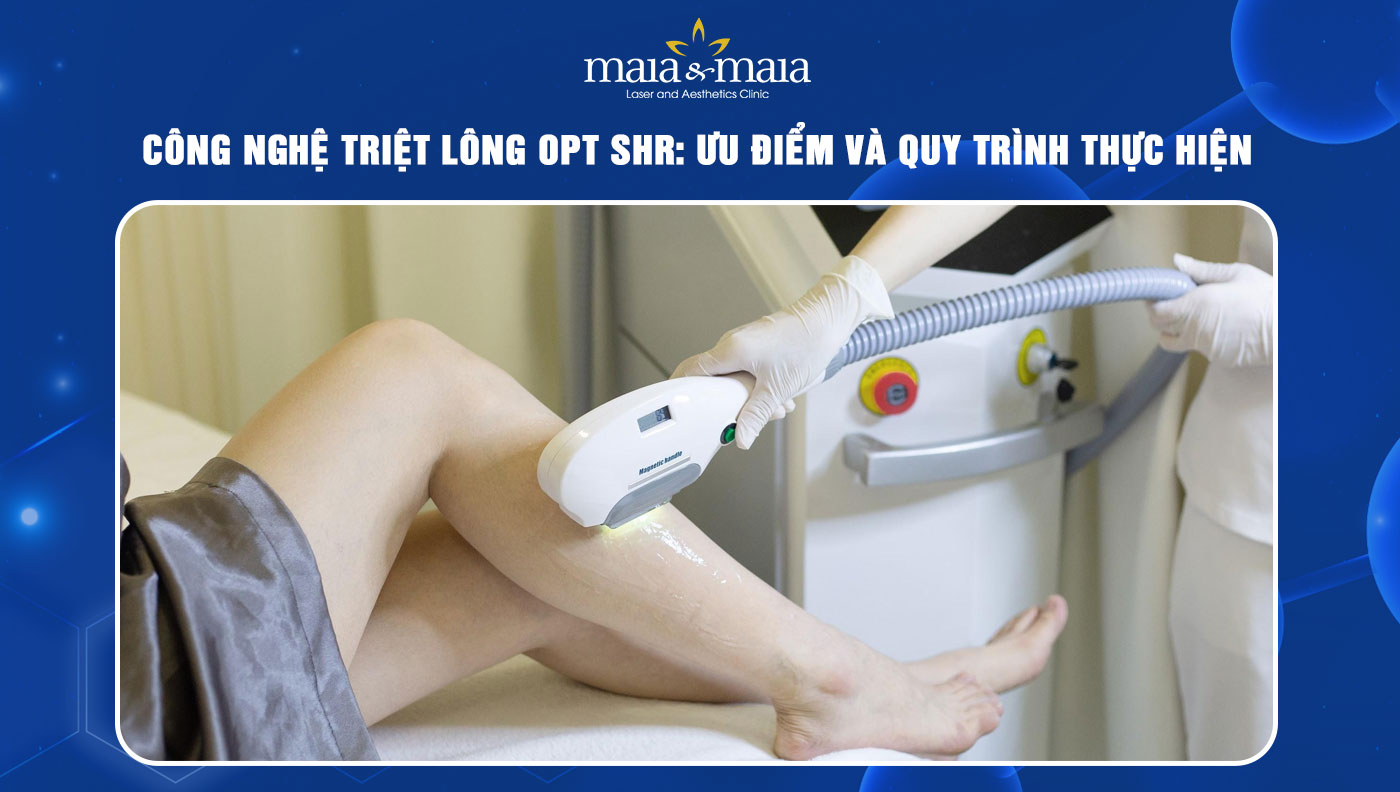 Công nghệ triệt lông OPT SHR: Ưu điểm và quy trình thực hiện