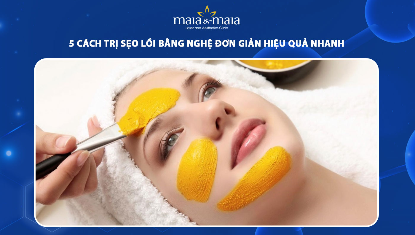 5 cách trị sẹo lồi bằng nghệ đơn giản hiệu quả nhanh chóng