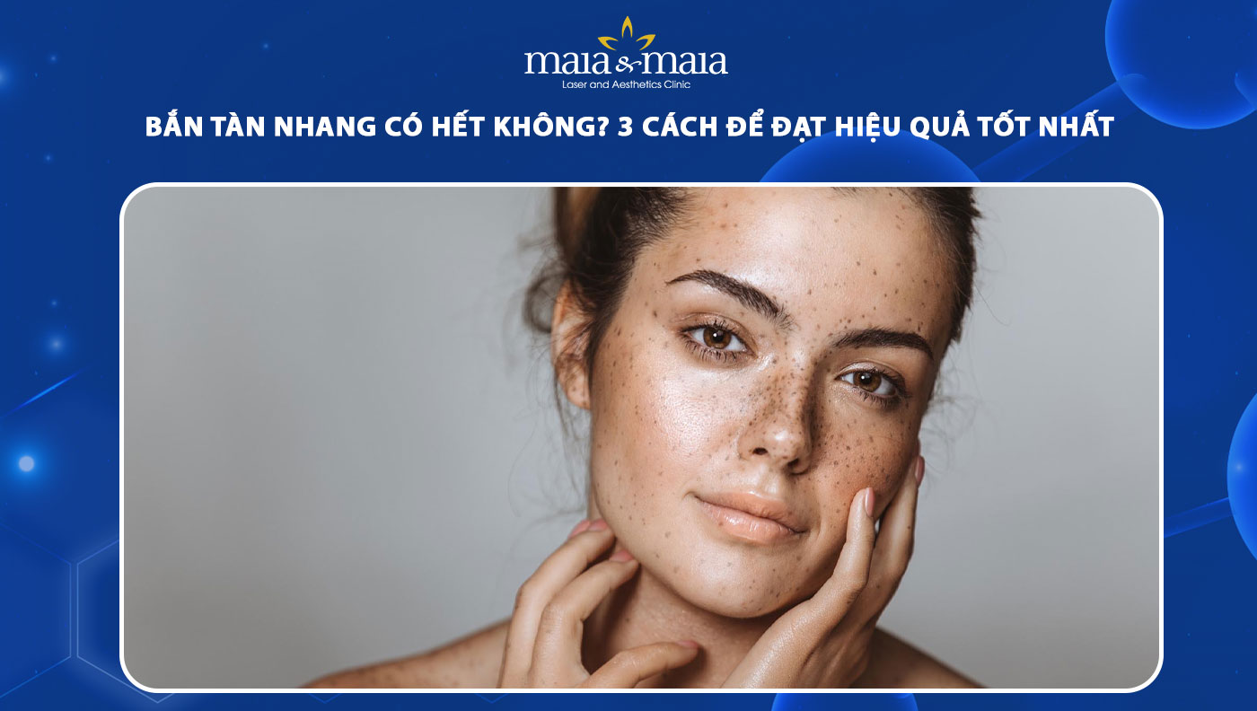 Bắn tàn nhang có hết không? 3 lưu ý để đạt hiệu quả tốt nhất