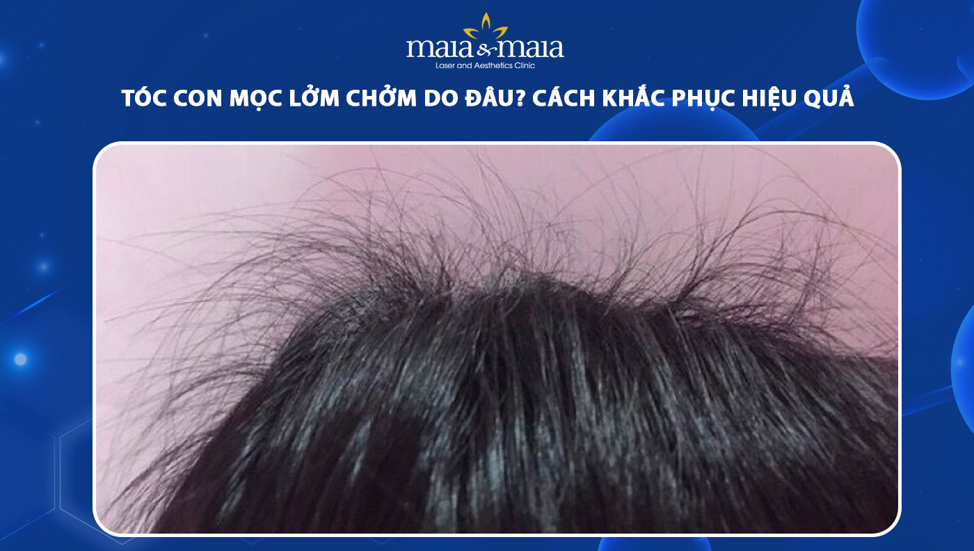 Tóc con mọc lởm chởm do đâu? Cách khắc phục hiệu quả