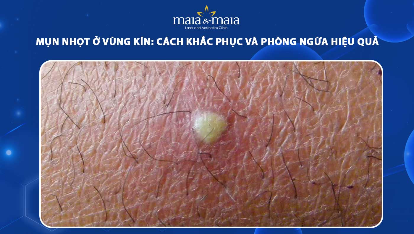 Mụn nhọt ở vùng kín do đâu? Cách khắc phục và phòng ngừa