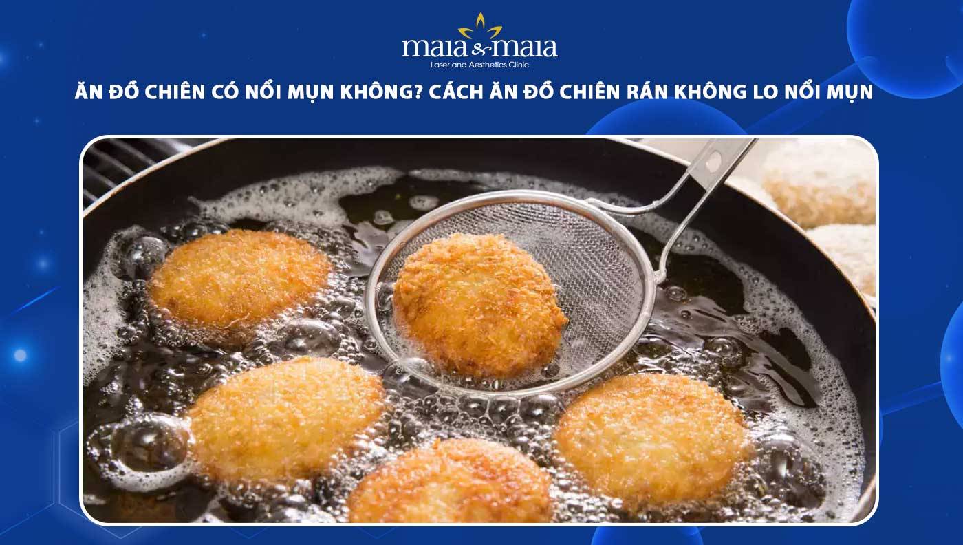 Ăn đồ chiên có nổi mụn không? Cách ăn không lo nổi mụn