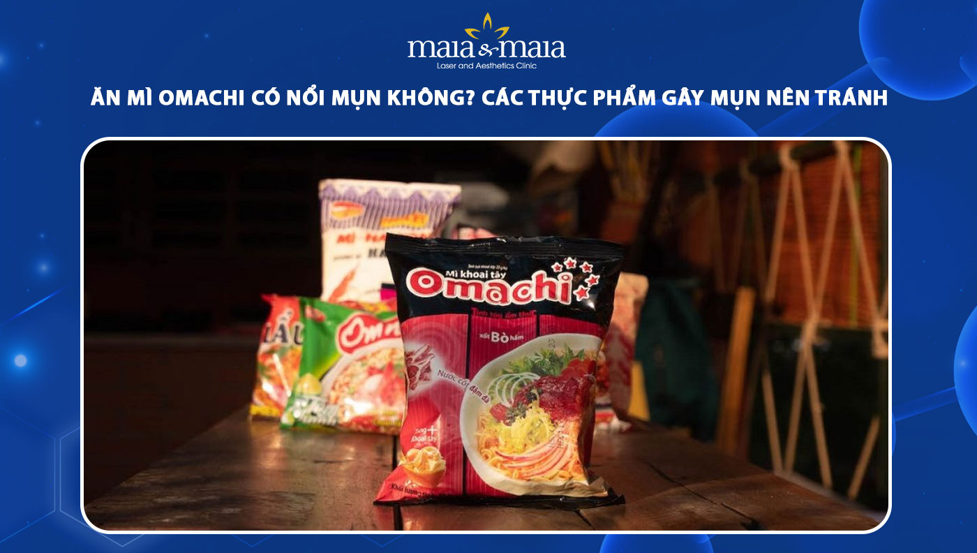 Ăn mì Omachi có nổi mụn không? Thực phẩm gây mụn nên tránh
