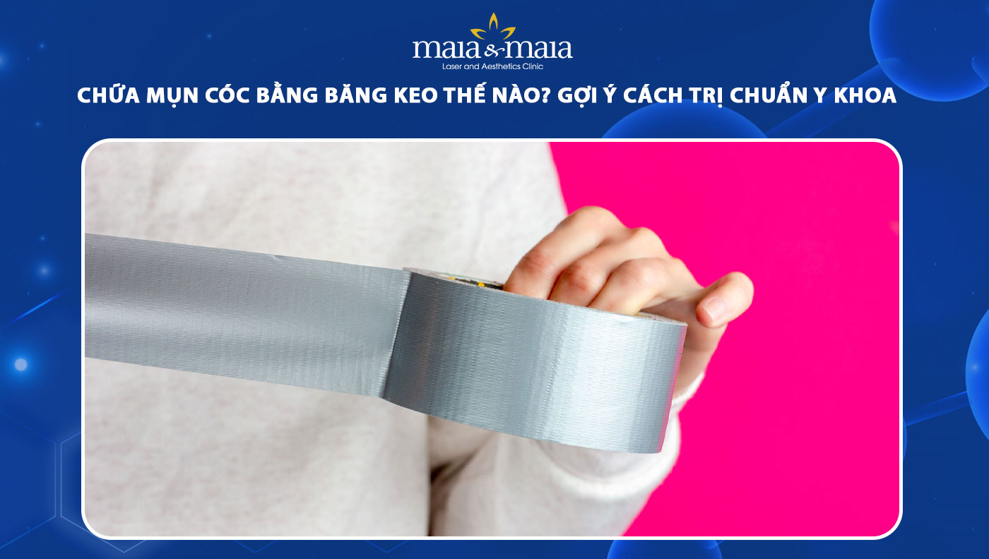 Chữa mụn cóc bằng băng keo thế nào? Cách trị chuẩn y khoa