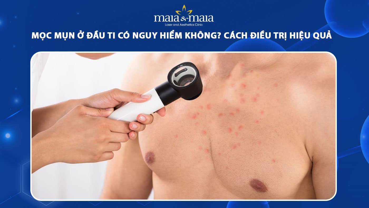 Mọc mụn ở đầu ti có nguy hiểm không? Cách điều trị hiệu quả