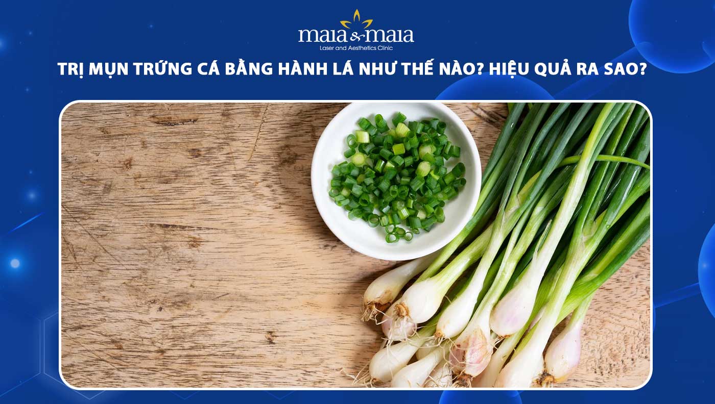 Trị mụn trứng cá bằng hành lá như thế nào? Hiệu quả ra sao?