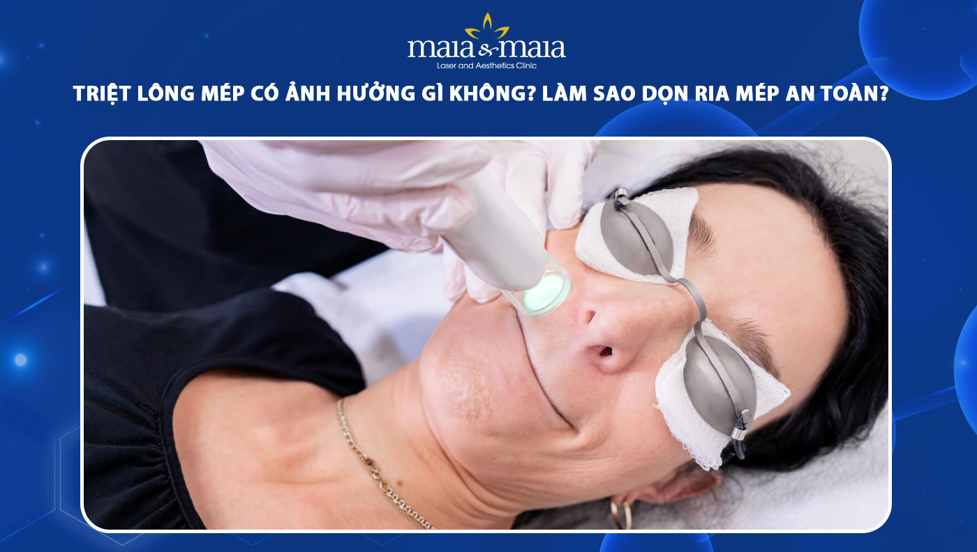 Triệt lông mép có ảnh hưởng gì không? Cách triệt an toàn