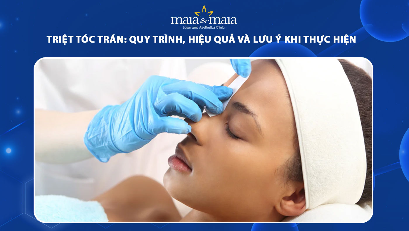Triệt tóc trán: Quy trình, hiệu quả và lưu ý khi thực hiện