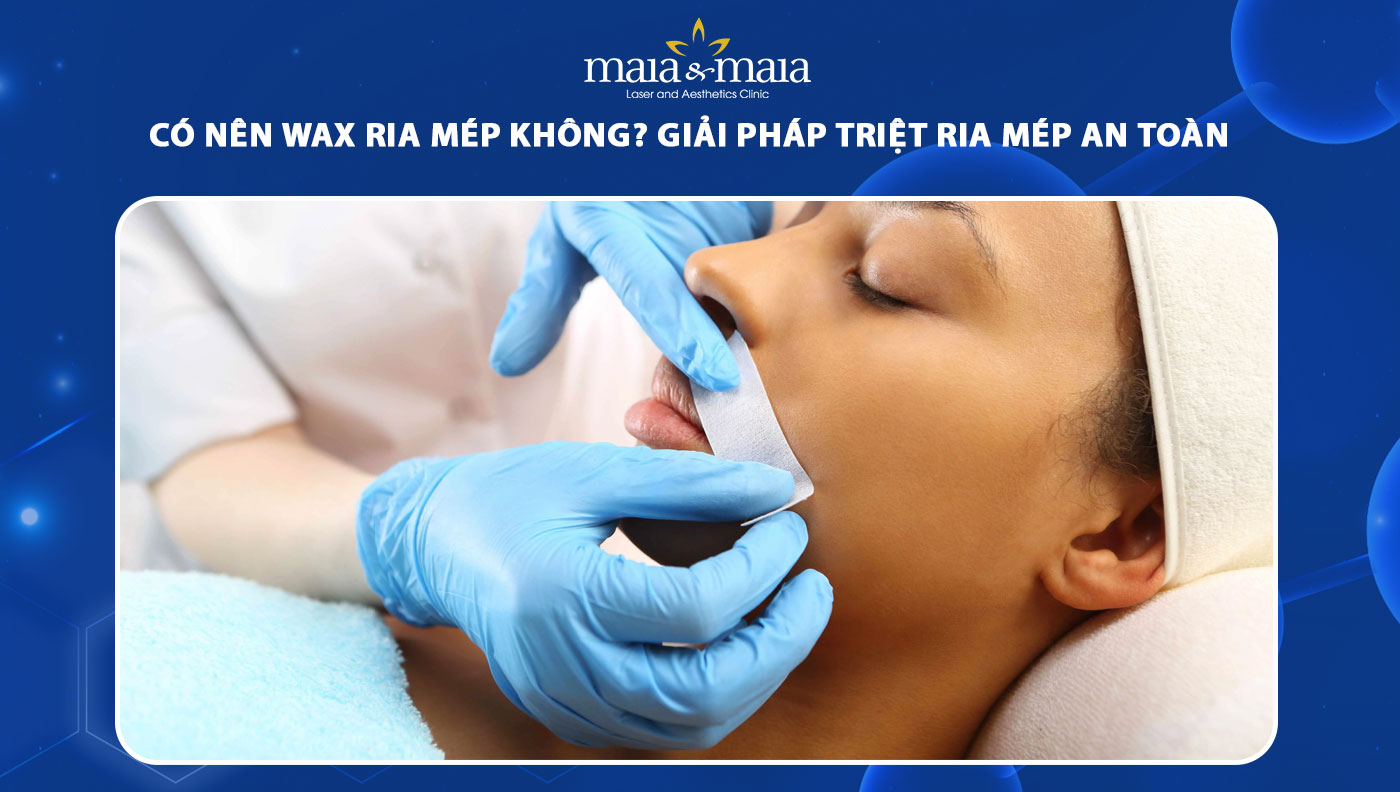 Có nên wax ria mép không? Giải pháp triệt ria mép an toàn